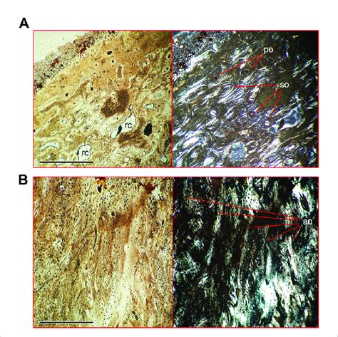 Microanatomical Structure Of The Cortex Of Pelvic Bone Nmnh P Cs 51 3