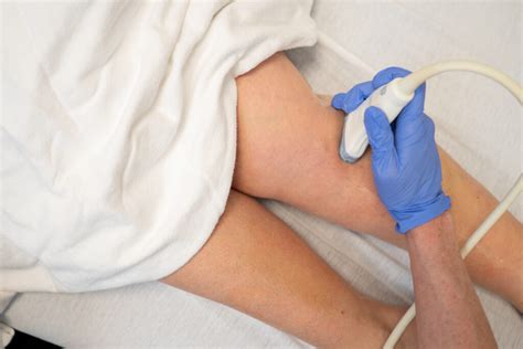 Blood Clots And Varicose Veins Simply Veins