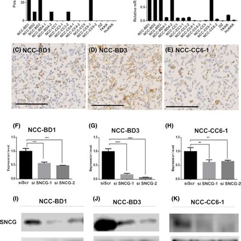 Survival Curves According To Gamma‐synuclein Sncg Expression Download Scientific Diagram