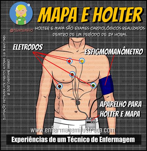 Diferença Entre Mapa E Holter Retoedu