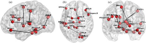 Top 10 Important Functional Connectivity Contributing The Most In Sz Download Scientific