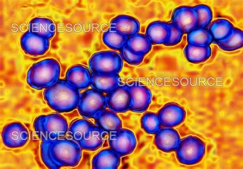 Meningococcus Bacteria Lm Stock Image Science Source Images