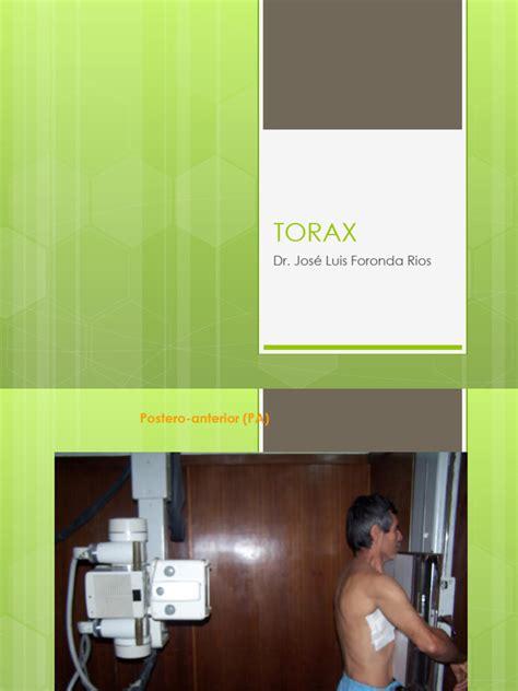 Evaluación Del Tórax Normal Pdf Aorta Pulmón