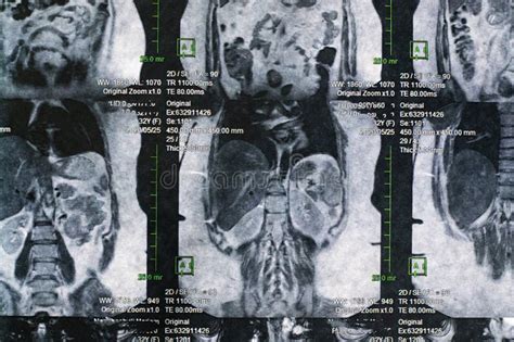 Magnetic Computer Tomography Stock Image Image Of Health Imaging 319105241