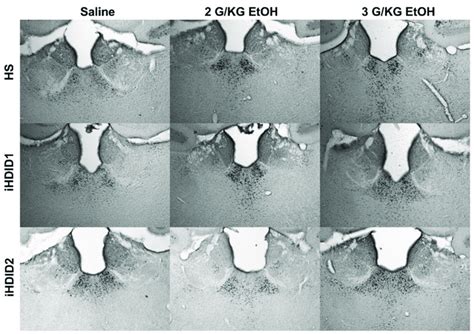 Lateral And Medial Habenula And Paraventricular Nucleus Of The Download Scientific Diagram