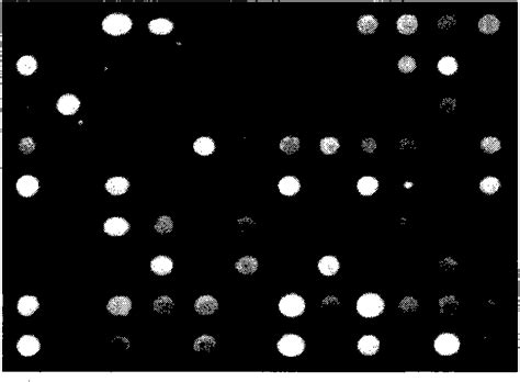 Particle Swarm Optimization Based Gene Chip Image Segmenting Method Of