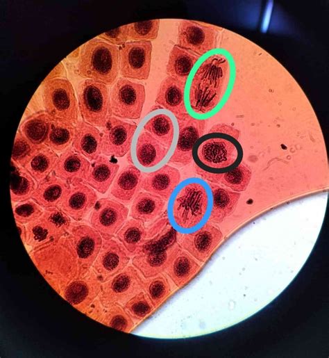 Preparasi Kromosom Pada Akar Bawang Merah Allium Cepa Halaman 1