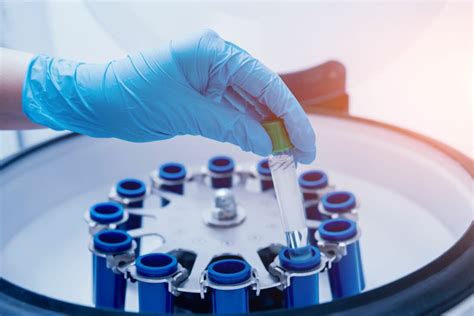 無標籤定量蛋白質組學 Label Free Quantitive Proteomics 龍欣科技股份有限公司 Edragon