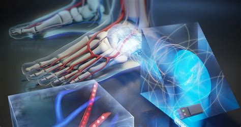 Single Shot 3d Photoacoustic Tomography Based On A Single Element Detector For Ultrafast Imaging