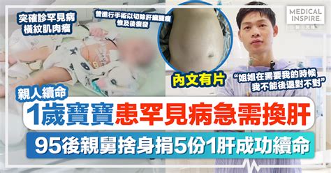 親人續命｜1歲寶寶患罕見病急需換肝，95後親舅捨身捐5份1肝成功續命：姐姐在需要我的時候，我不能後退對不對。（內文有片）