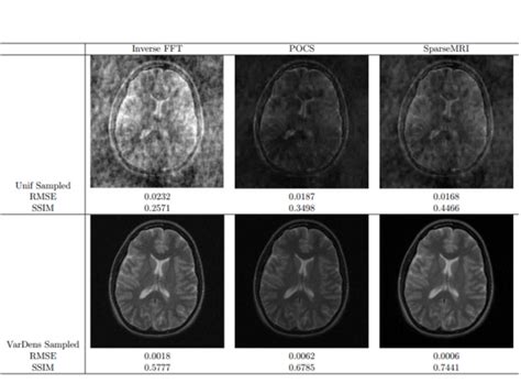 Mri Image Reconstruction From Undersampled K Space Data Prakhar Kulshreshtha