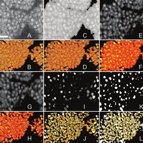 Pollen Massulae Ovules Pollen Ovule Ratio And Phylogeny A Pollen