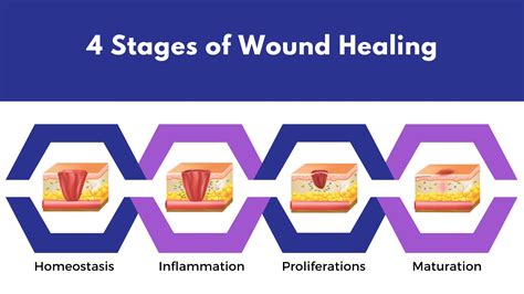 What Is Wound Care Specialist Treatment Dressings Types Healing