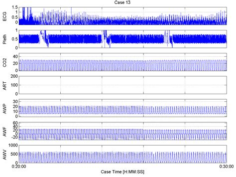 Case 13 Waveform Plots 600 Second Plots