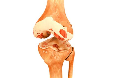 รูปภาพfibia เลือกดูภาพถ่ายสต็อก เวกเตอร์ และวิดีโอ14 769 Adobe Stock