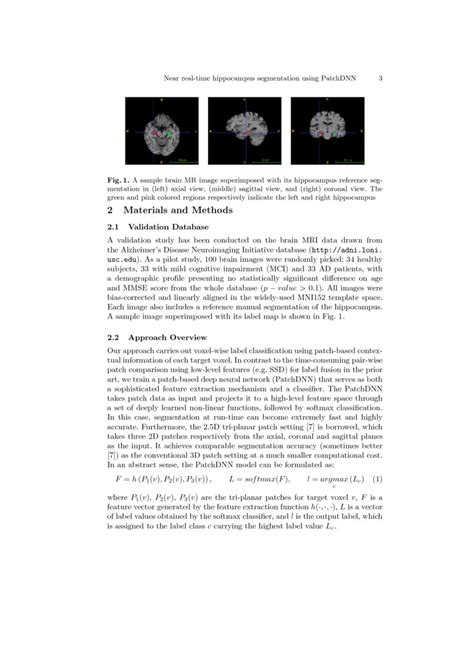 near real time hippocampus segmentation using patch based canonical