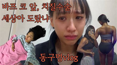 바디프로필 촬영 앞두고 수술이라니 결국 운동 1도 못하고 촬영함 식욕떨어질 수 있음 주의밥 먹을 때 시청금지 다이어터의 수술 회복 브이로그 Youtube
