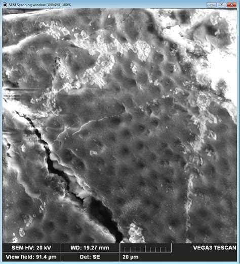 Initial Demineralization Of Enamel Prisms Download Scientific Diagram