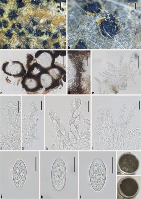 Botryosphaeria Dothidea Facesoffungi Number Fof 03512 Faces Of Fungi