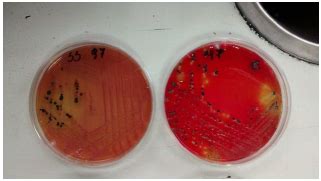 Diferentes Métodos Para Aislamiento Y Detección De Salmonella Spp En