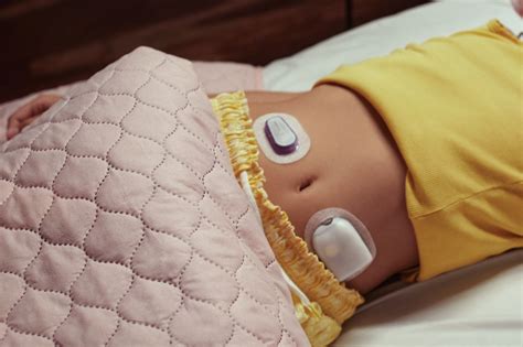 Omnipod Pressmedia Kit Omnipod