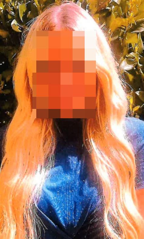 Trevor Bauer Accuser S Lawyers Reveal New Horror Injury Pic And Say It S Impossible Sex