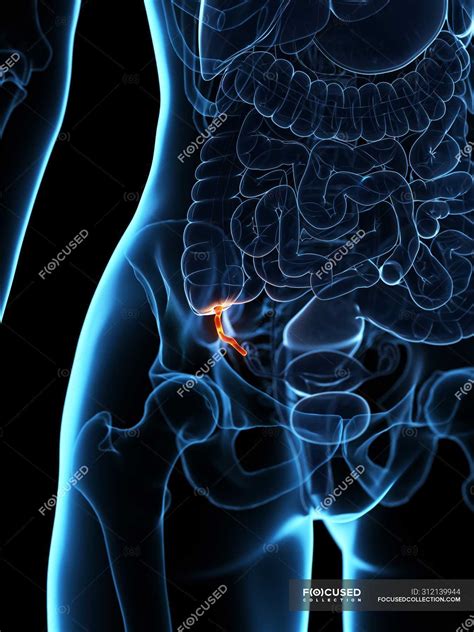 Inflamed Appendix In Human Body Conceptual Digital Illustration Infection Artwork Stock