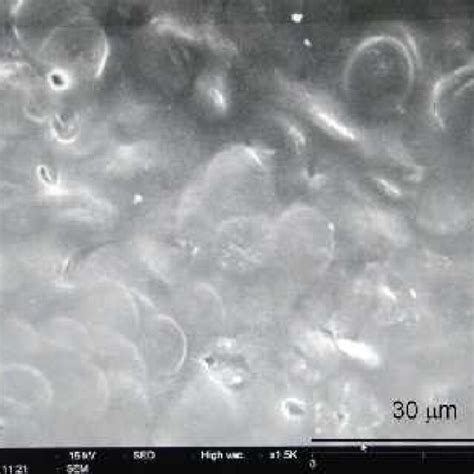 Scanning Electron Microscope Sem With Secondary Signal Of The Human Download Scientific