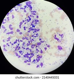 Intracellular Bacteria Images Stock Photos Vectors Shutterstock