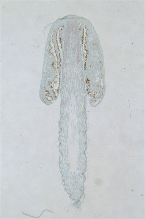 Basidiomycota Coprinus Labeled
