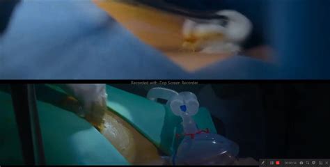 Woman Heart Surgery Scene Thisvid Com