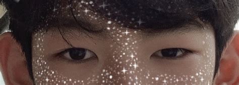 의사에게 물어보세요 안녕하세요 아이 눈 강남언니 1등 성형수술and피부시술 정보앱