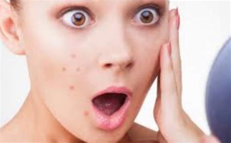 Ways To Reduce The Swelling And Redness Of Pimples