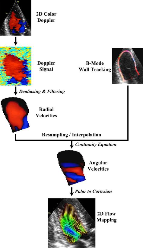 Figure 2 From Two Dimensional Intraventricular Flow Mapping By Digital Processing Conventional