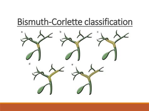 Hilar Cholangiocarcinoma Pptx Hilar Cholangiocarcinoma Pptx