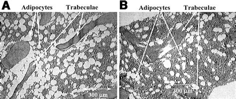Adipocyte Spatial Distributions In Bone Marrow Implications For Skeletal Dosimetry Models
