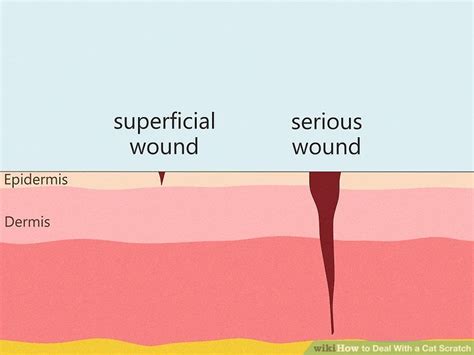 5 Ways To Deal With A Cat Scratch WikiHow