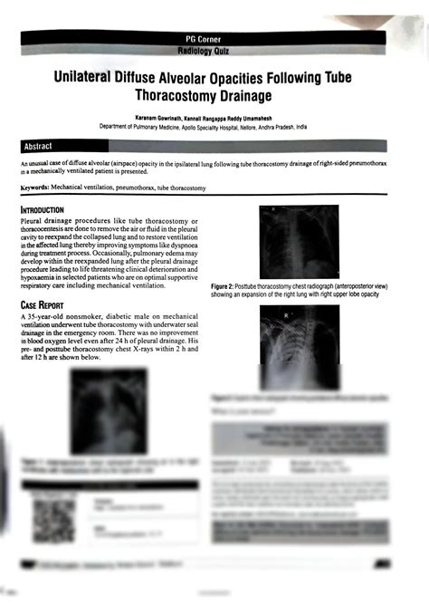 SOLUTION Unilateral Diffuse Alveolar Opacities Following Tube Thoracostomy Drainage Studypool