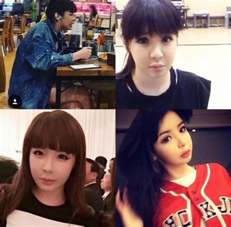 박봄 성형변천사 예뻤던 얼굴 어디가고