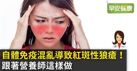 自體免疫混亂導致紅斑性狼瘡跟著營養師這樣做