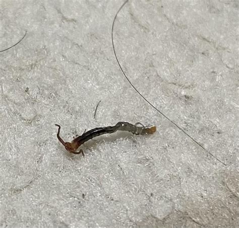 Can Anyone Help Me What This Small Bug Worm Thing Is It Bit My