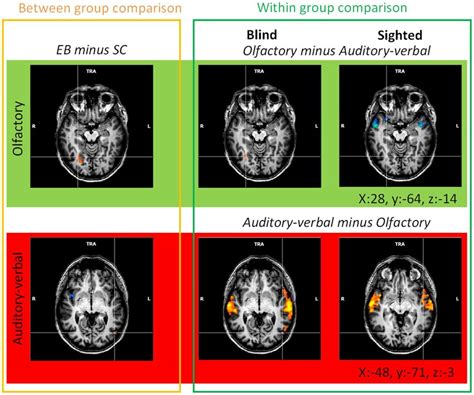 Dissociation Between Olfactory And Auditory Verbal Processing In The