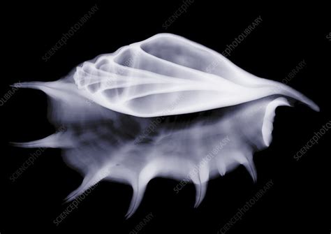 Conch Shell X Ray Stock Image F029 9402 Science Photo Library
