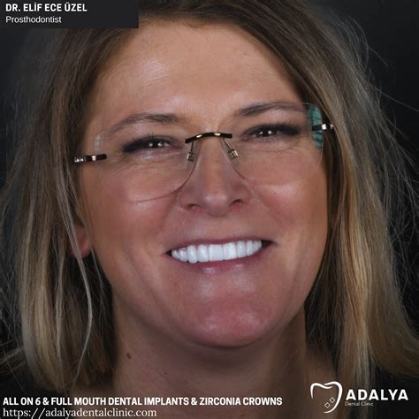 Full Mouth Dental Implants Turkey Package Deals Full Set Implants Cost