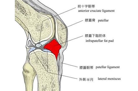 【膝の痛みで多い原因】軟骨なんかじゃない！？