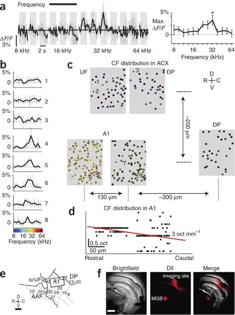 Dichotomy Of Functional Organization In The Mouse Auditory Cortex Nature Neuroscience