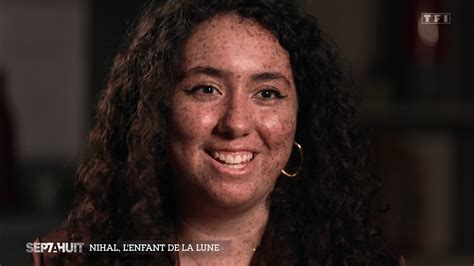 Sept à Huit les internautes touchés par l histoire de Nihal enfant de la lune