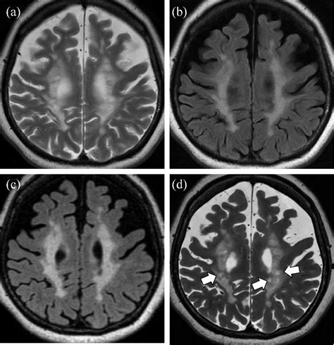 Figure 2 From Thin Slice Two Dimensional T2 Weighted Imaging With Deep Learning Based