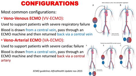 Ppt Ecmo Final Powerpoint Presentation Free Download Id 13830585