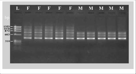 Gel Photograph Showing Standardized Buffer Components Of Glucose 900g Download Scientific